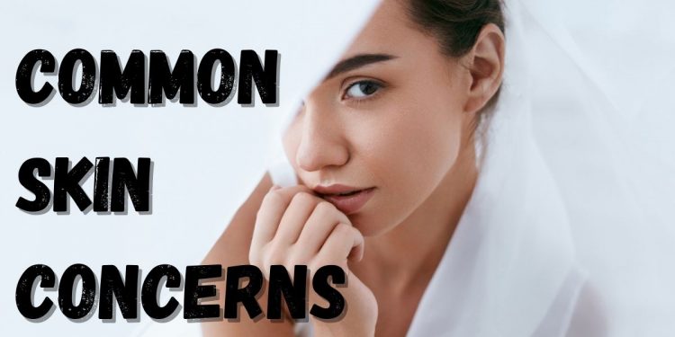 What Are The Most Common & Top Skin Concerns?