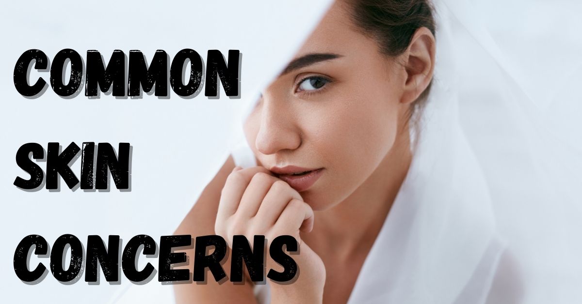 What Are The Most Common & Top Skin Concerns?
